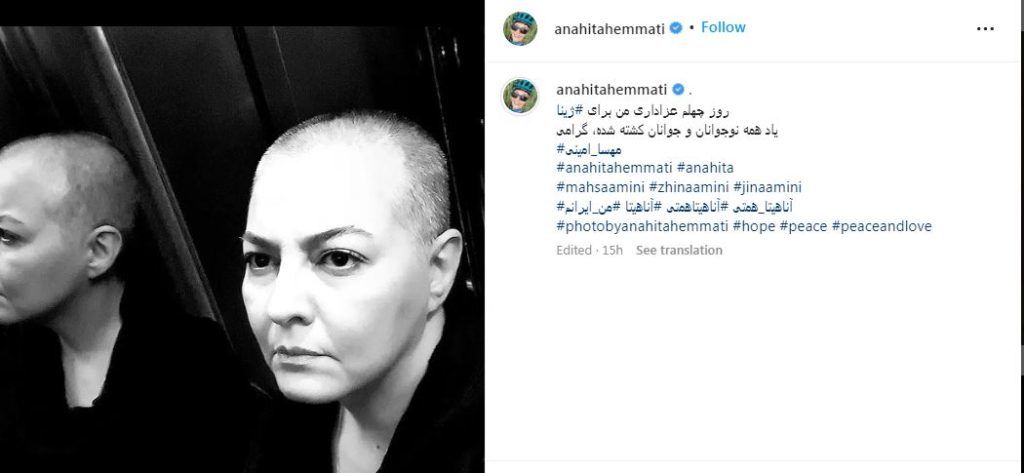 عکسی باورنکردنی؛ خانم بازیگر یک شبه پیر شد عکس